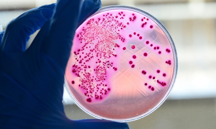 Microbial Scan | Cannabis Testing | PPB Analytical Inc.